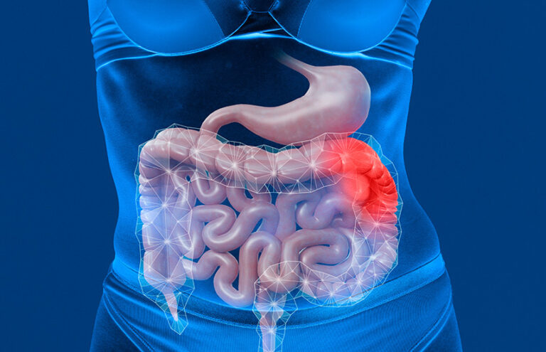 Bifidobacterium Infantis: A Comprehensive Guide | Bioma Health